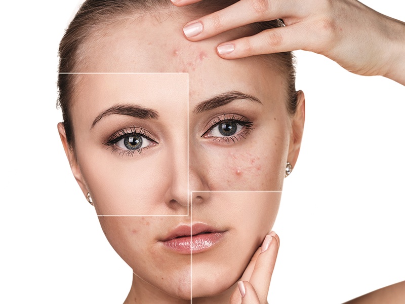 Skin diseases ranked fourth most common illness